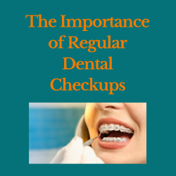 The Importance of Regular Dental Checkups